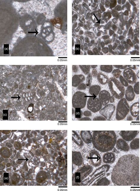 Benthic Foraminifera A Istriloculina Eliptica B Trocholina
