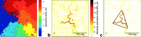 A Activation Map Of Re Entry Circuit In Hl1 6 Dominant Frequency Download Scientific