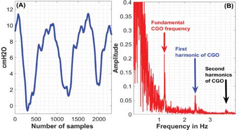 A Singular Spectrum Analysis Based Data Driven Technique For The Removal Of Cardiogenic