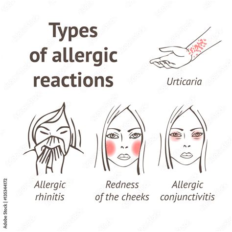 What Are The 4 Types Of Allergic Reactions At Georgia Levvy Blog