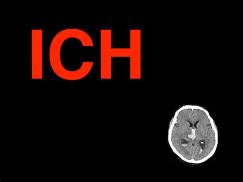 Prognostication In Neuro Disasters Pdf