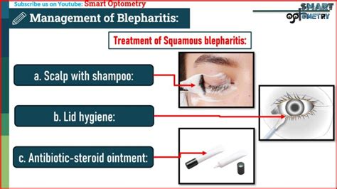 Blepharitis Introduction Causes Symptoms Signs Treatment