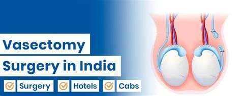 Vasectomy Procedure Types And Advantages Cureindia