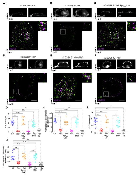Nef Co Opts The Switch Like Function Of Synaptic Lck In Promoting Tcr Download Scientific