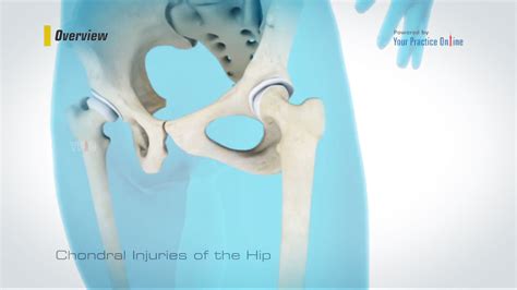 Pediatric Surgery Videos Your Practice Online Education