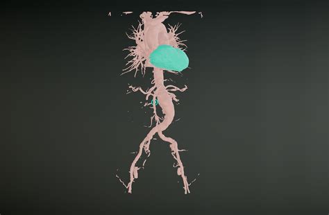 render artifacts in r154 questions three js forum