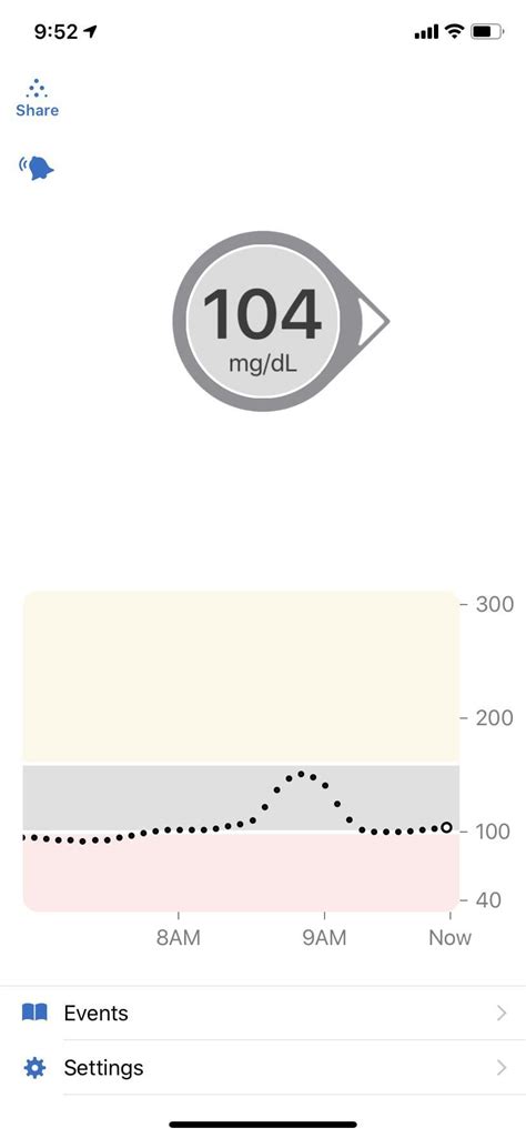 Dexcom Readings Risefall During And Posy Shower More In Comments R
