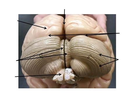 Brain Models