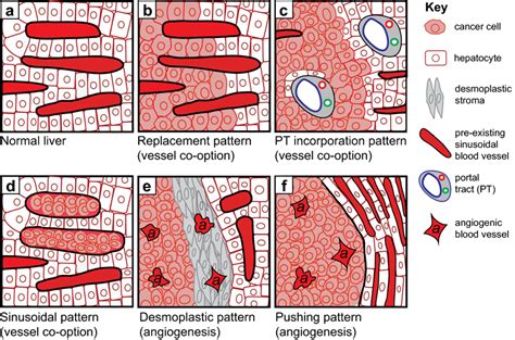 Tumour Growth Patterns Associated With Vessel Co Option Or Angiogenesis Download Scientific