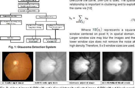 Figure 9 From Segmentation Of Optic Nerve Head For Glaucoma Detection