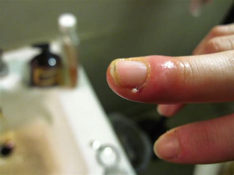 Ever Heard Of The Clostridium Difficile Epidemic Survivors Speak Amazons Watch Magazine