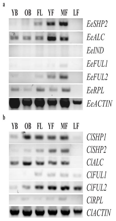 Reverse Transcriptase Polymerase Chain Reaction Rt Pcr Expression