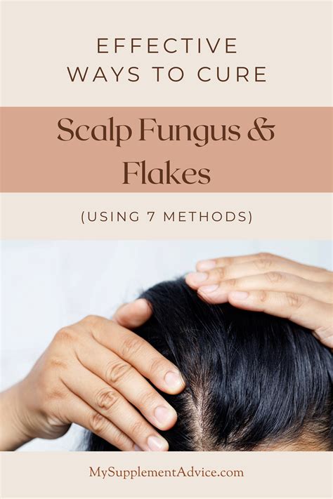 How To Get Rid Of Scalp Fungus Flakes In 7 Steps Artofit