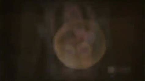 Dr Daniel Looi On Linkedin Exosome Regenerativemedicine