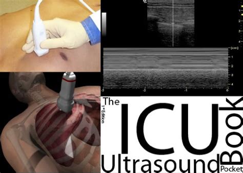 The ICU Ultrasound Pocket Book Original PDF From Publisher Afkebooks Medical Ebooks For