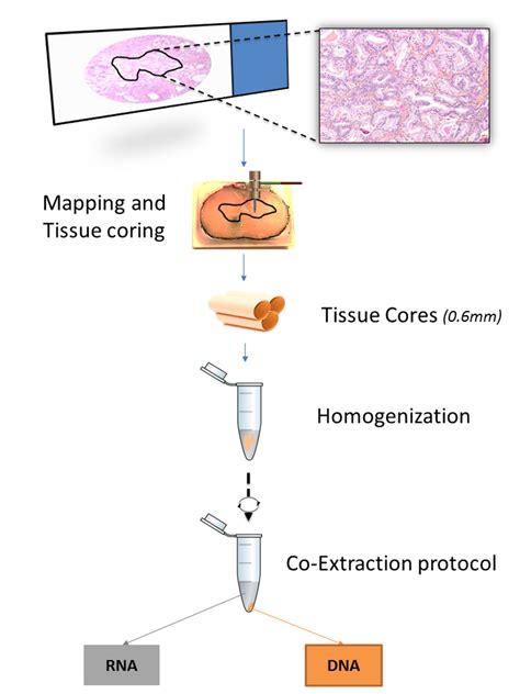 Preparation Of Formalin Fixed Paraffin Embedded Tissue Cores For Both