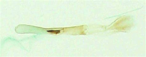 Male Genitalia