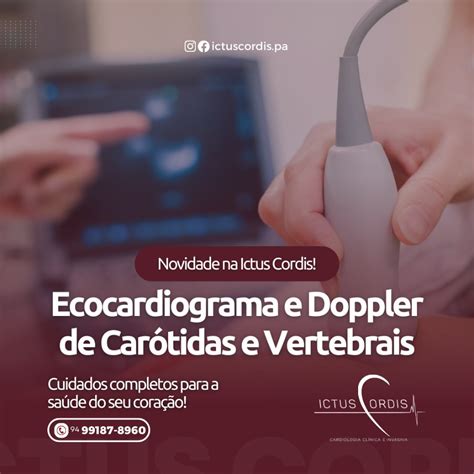 Ictus Cordis