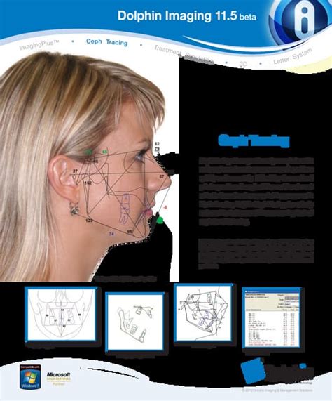 Dolphin Ceph Tracing Tool Pdf