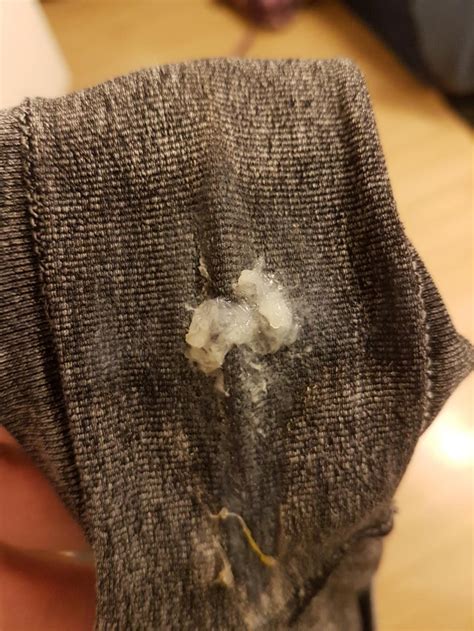 Could Anyone Tell Me If This Is Vaginal Discharge Or Is This Semen If