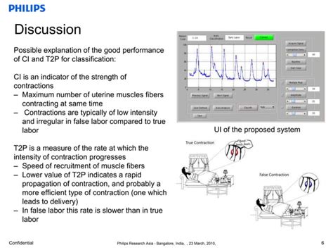 Dphilipspregnancy Monitoringtraineesctgama Ieeeautomated Uterine Contraction Analysis For