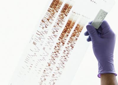 Controversy In DNA Profiling How DNA Profiling Works HowStuffWorks