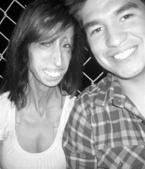 The Story Of 21 Year Old Lizzie Velasquez 17 Pics