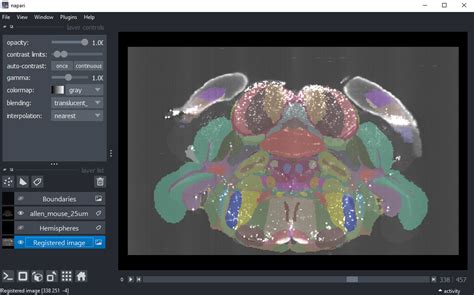 optimize brainreg registration usage and issues image sc forum