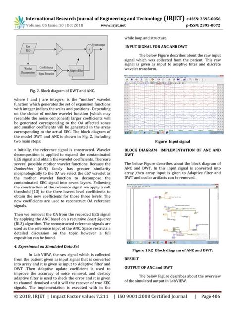 Irjet An Efficient Approach For Removal Of Ocular Artifacts In Eeg Brain Computer Interface