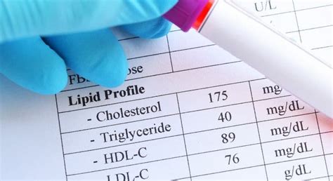 When Should You Check Cholesterol Uk Screening Age Guide Private