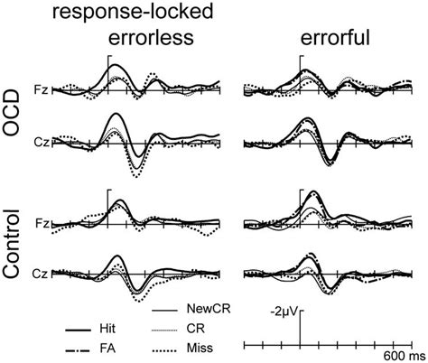 Response Locked Potentials For Ocd And Control Group Response Locked