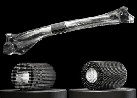 unique 3d printed bioresorbable implants for patient specific bone repair 3d printing industry