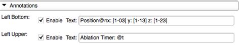 Documentation Modules CornerAnnotation Slicer Wiki
