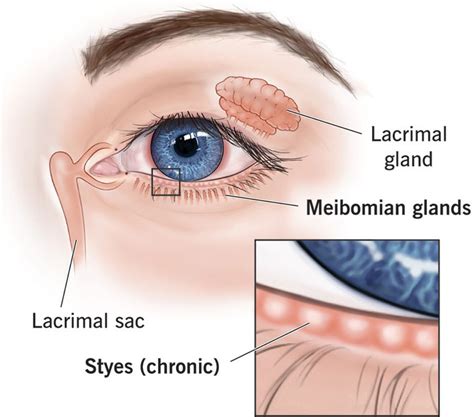 Your Vision Matters The Best Eye Hospital In Mumbai For Mgd Treatment
