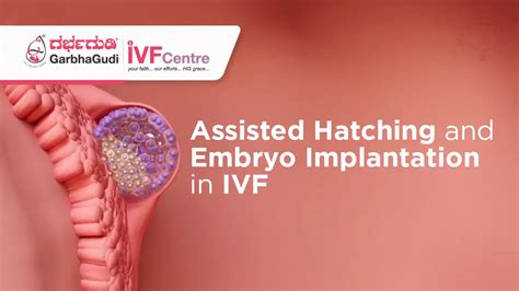 Assisted Hatching In Ivf How It May Improve Embryo Implantation