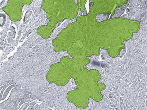 Automated Quality Control For Digital Pathology Slides