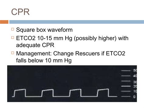 Etco2 In Non Intubated Patient A Must In Ed Ppt