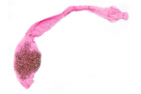 Echinococcus Multilocularis Zowiac En