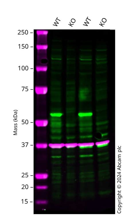 Anti E2f1 Antibody Epr26698 49 Ko Tested Ab314311 Abcam