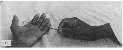 Ulnar Nerve Motor Function Test