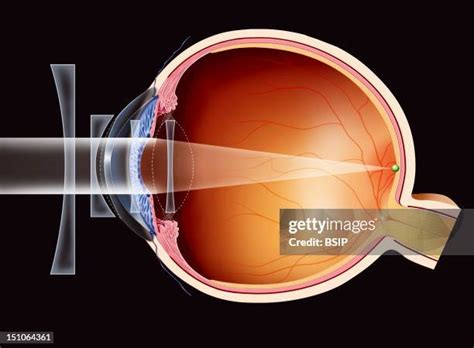 Anterior Eye Photos And Premium High Res Pictures Getty Images