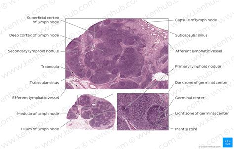 Histology Of Lymphatic Vessels And Surrounding Tissue A