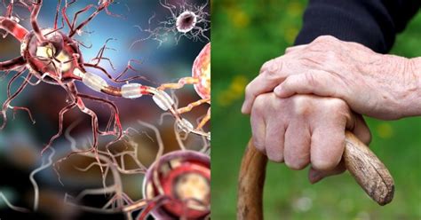 თუ ხელები გიკანკალებთ 14 სერიოზული შესაძლო მიზეზი