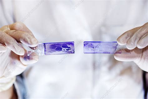 Stained Microscope Slides Stock Image F0245620 Science Photo Library