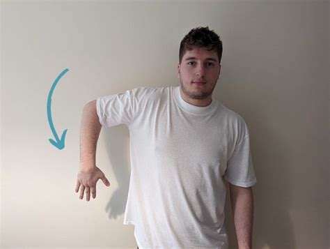 Shoulder Dislocation Types Treatment And X Rays Explained