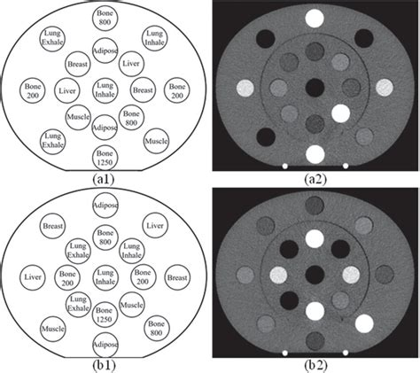 transversal representation of cirs 062m electron density phantom