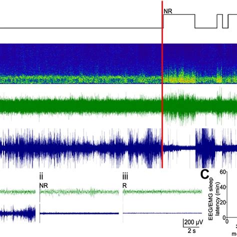 Electroencephalography EEG Validation Of Behavioral Scoring Of Download Scientific Diagram