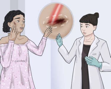 Scars How To Articles From WikiHow