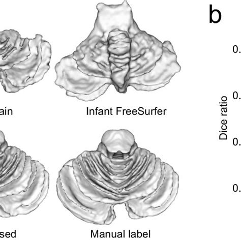 segmentation comparison of five methods for 6 month old subjects