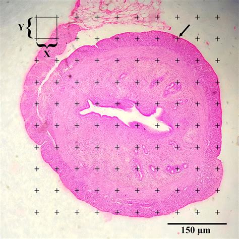 Point Counting Method Was Used To Estimate The Volume Of Different Download Scientific Diagram